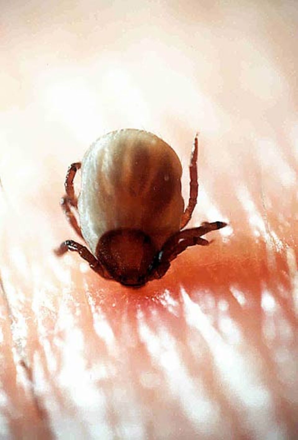 Fotoshow: Zecken - Bild 4 - [GEO]