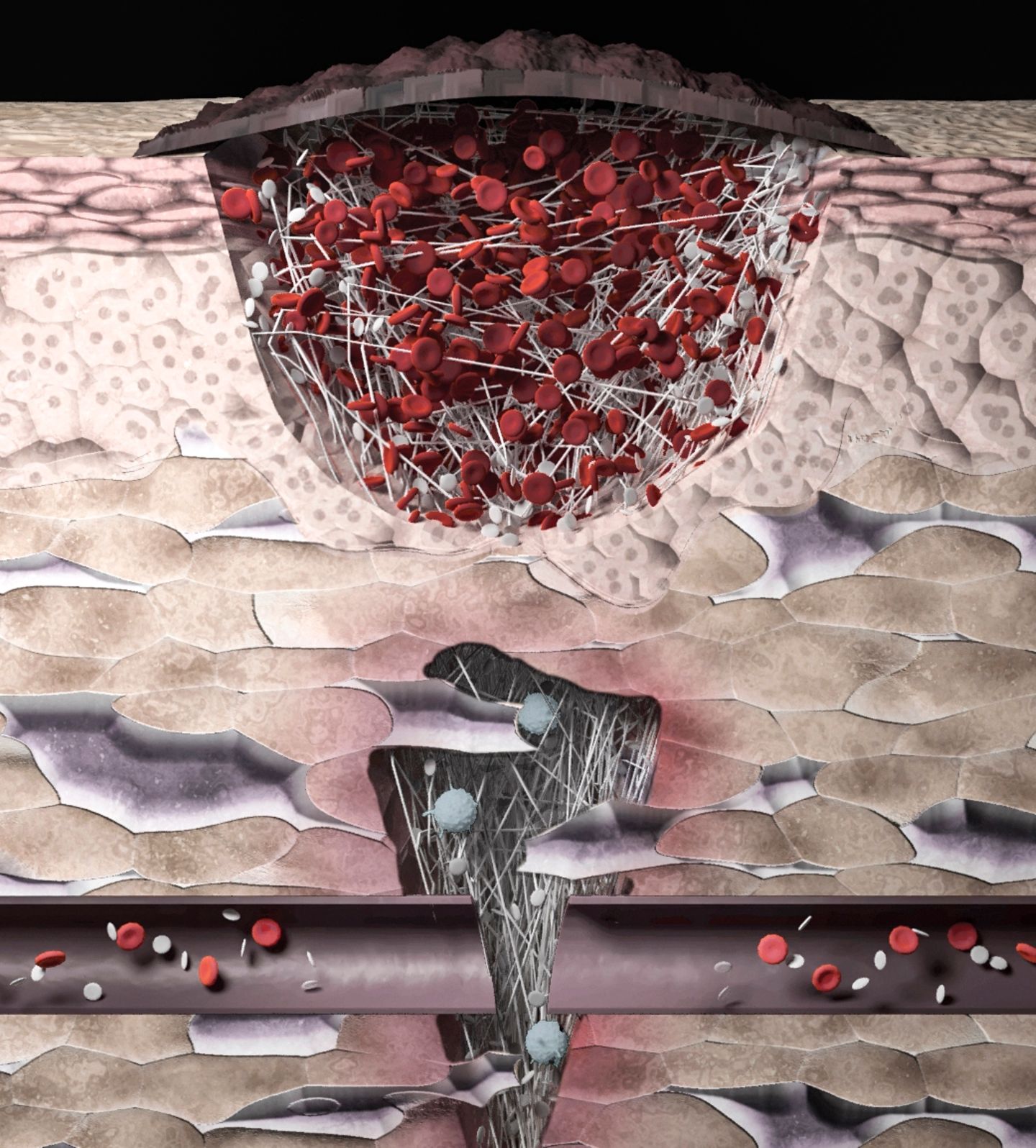 Die vier Schritte der Wundheilung - [GEO]