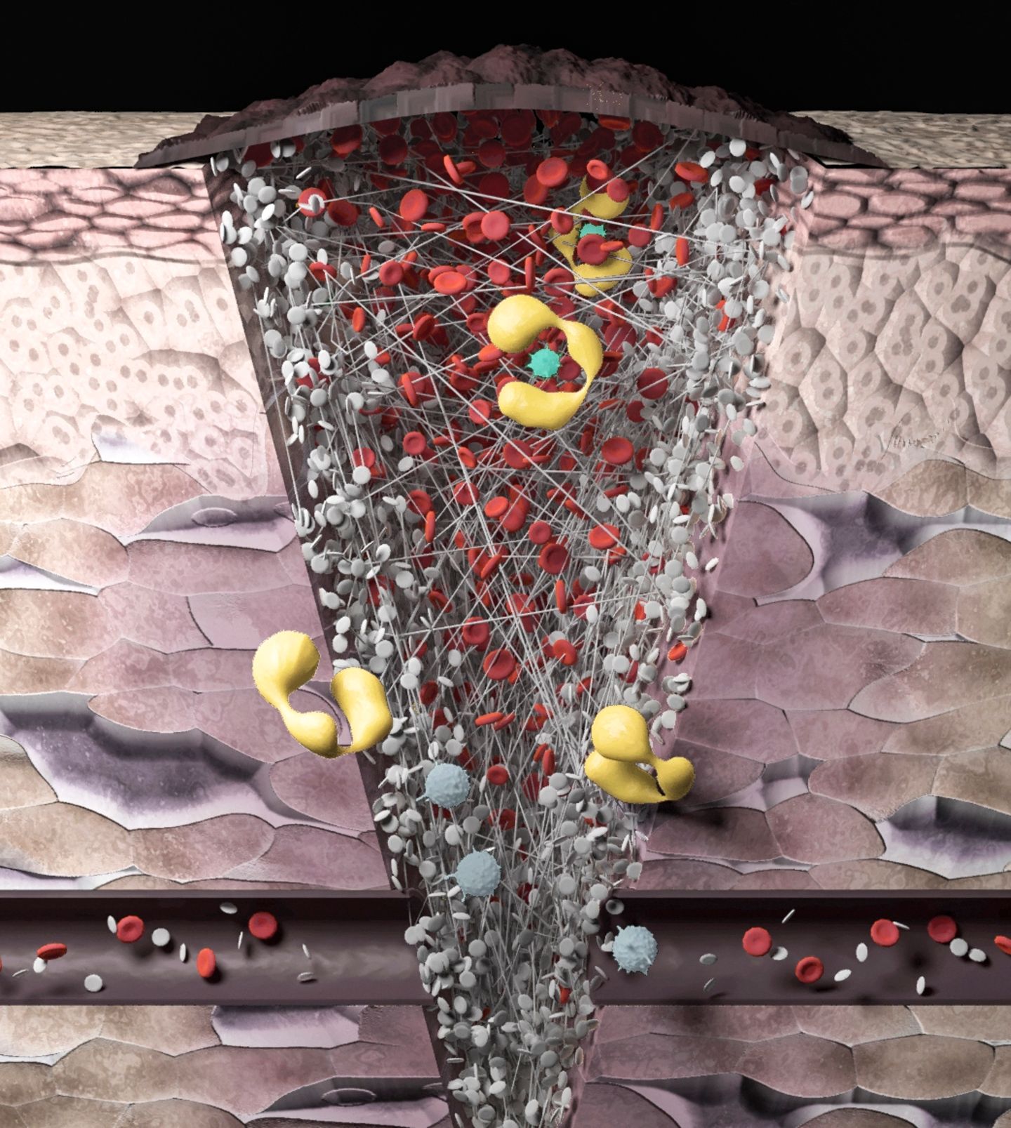 Die vier Schritte der Wundheilung - [GEO]