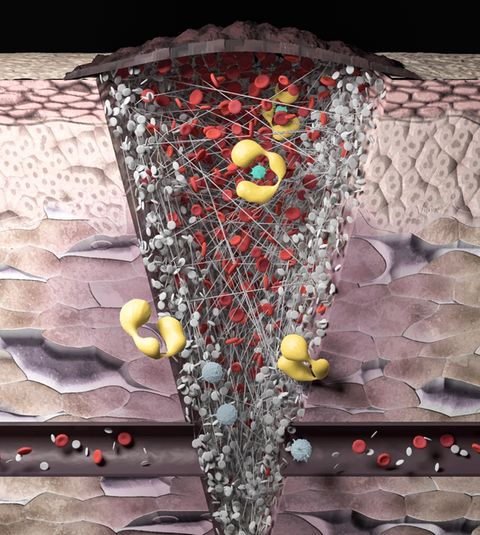 Die vier Schritte der Wundheilung - [GEO]