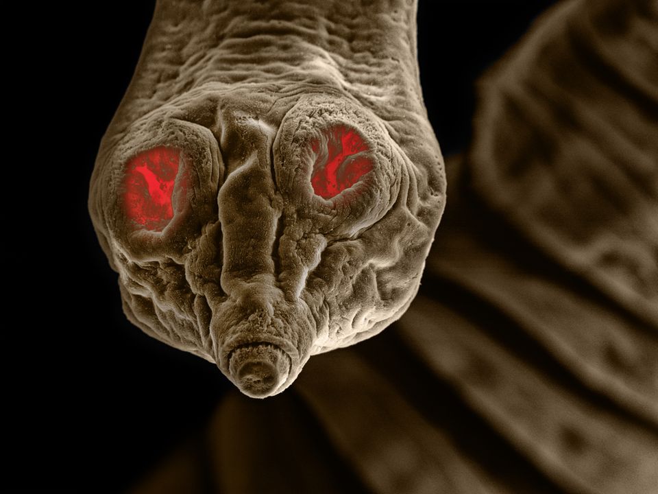 Mikroskopbilder enthüllen die schaurige Welt der Parasiten - [GEO]