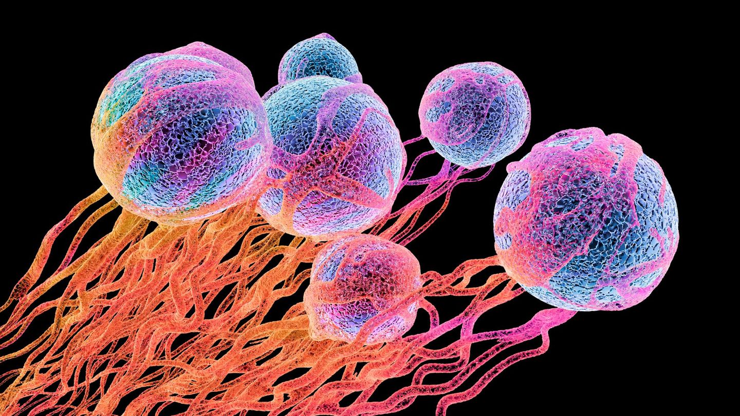 mRNA-Impfung gegen Hautkrebs: Studie zeigt erste Erfolge - [GEO]